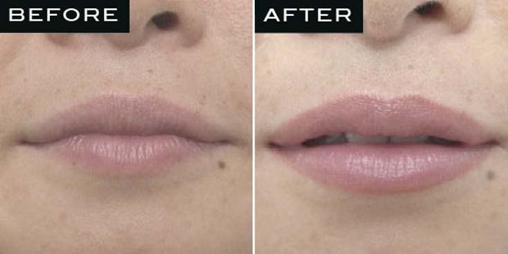 Micropigmentation - Eudelo